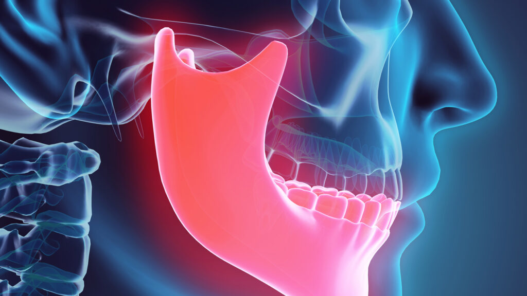 University of Washington Surgeons Rebuild Patient’s Jaw and Hard Palate ...
