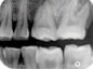 Techniques to Enhance Radiographic Utility - Decisions in Dentistry