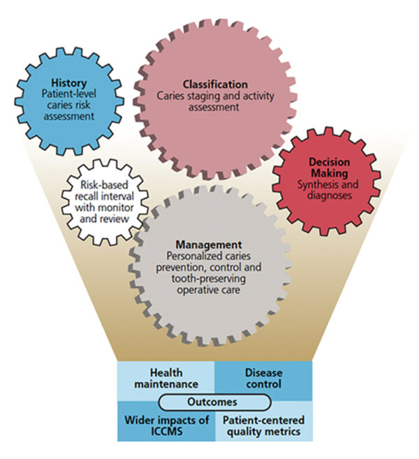 Conservative Caries Treatment - Decisions in Dentistry
