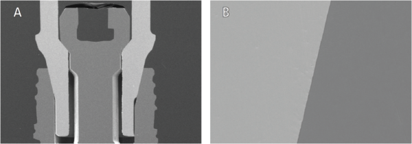 Understanding Implant Abutment Connection Interfaces