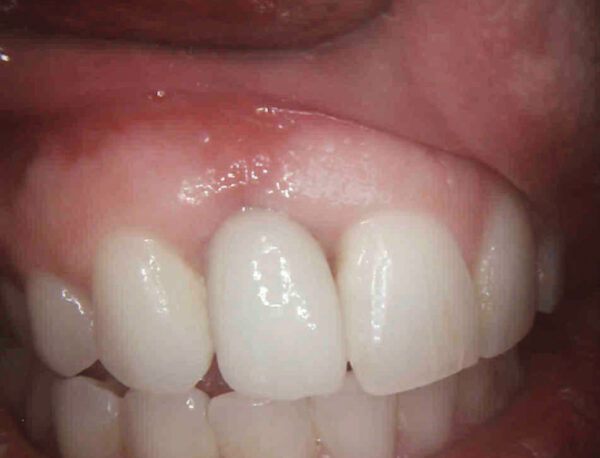 Imaging Technologies in Dental Implantology