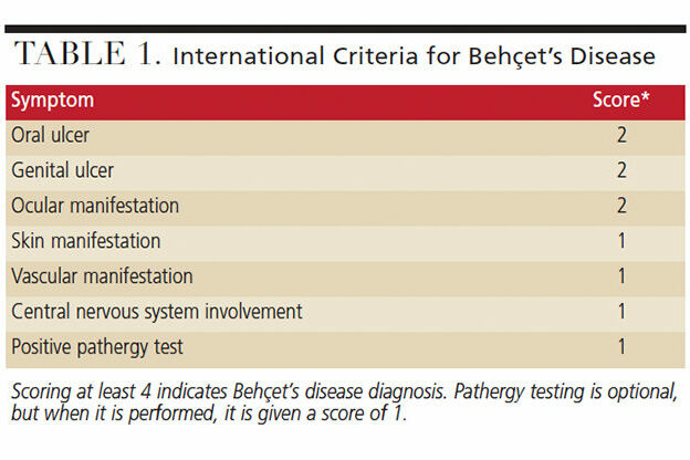 Clinical Presentation of Behçet’s Disease – Decisions in Dentistry