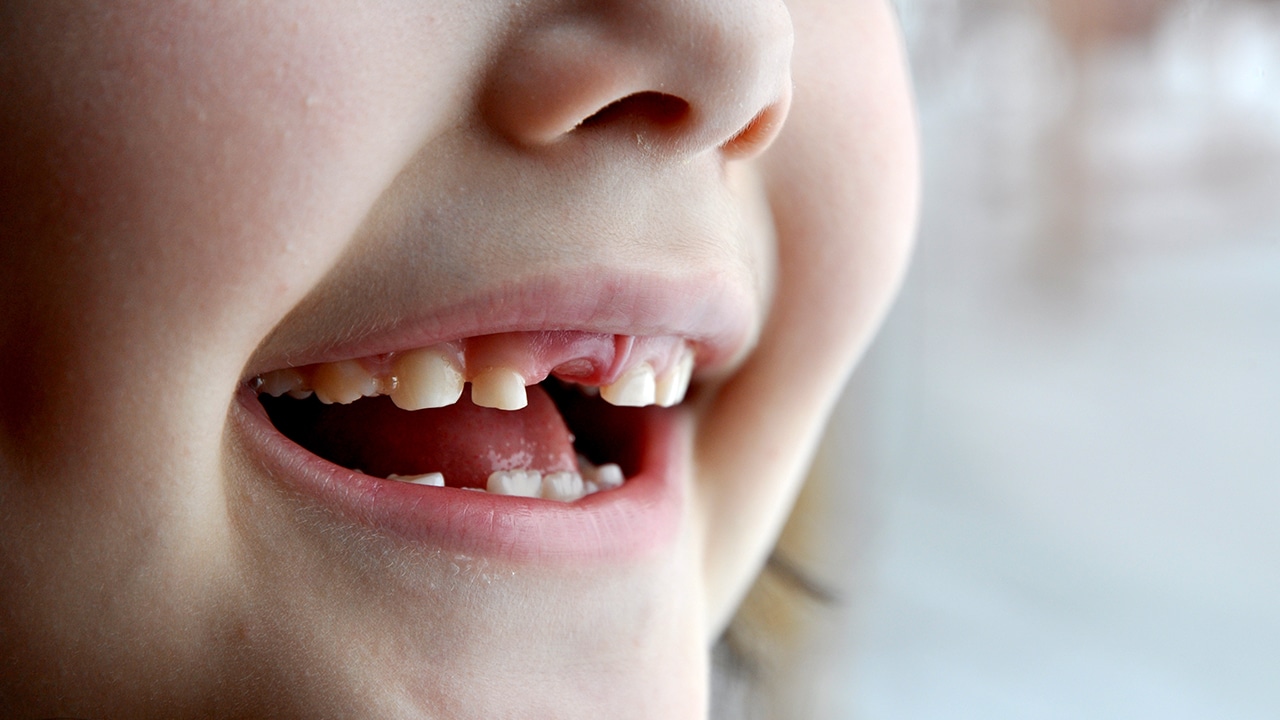 Milk Teeth Provide Insight To Modern Health Decisions In Dentistry