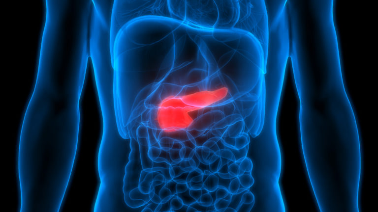 Study: Tongue Microbiome May Help Identify Pancreatic Cancer ...