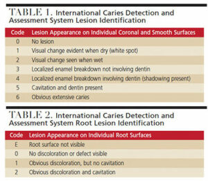 Saliva, Remineralization And Dental Caries - Decisions in Dentistry