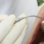 GINGI-FEATURED - Decisions in Dentistry