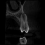 Endo figure 1 F - Decisions in Dentistry