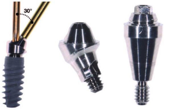 Implant Treatment Planning for Hybrid Prostheses - Decisions in Dentistry