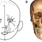 cleft-table-2 - Decisions in Dentistry