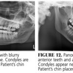 panorex-fig-2 - Decisions in Dentistry