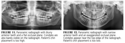 Optimal Panorex Imaging - Decisions in Dentistry