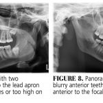 panorex-fig-9-10 - Decisions in Dentistry