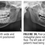 panorex-fig-5-6 - Decisions in Dentistry