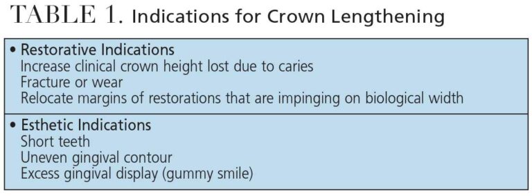 Concepts and Considerations for Surgical Crown Lengthening - Decisions ...