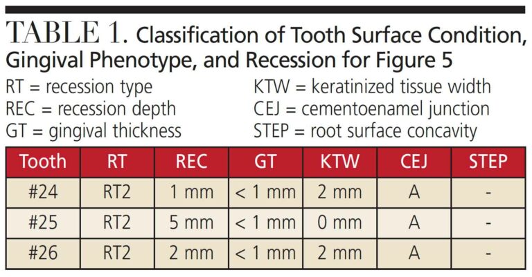 Decision-Making In Modern Mucogingival Therapy - Decisions in Dentistry