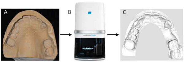 Utilizing a Digital Workflow for Implant Treatment Planning - Decisions ...