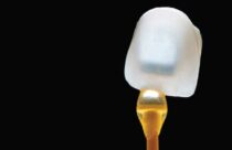 10 Steps to Rubber Dam Isolation in Restorative Therapy