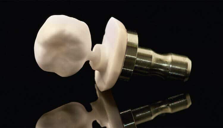 milling-technologies - Decisions in Dentistry