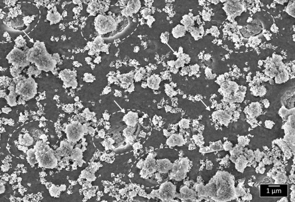 Preventing Oral Diseases With Biomimetic Hydroxyapatite - Decisions in ...