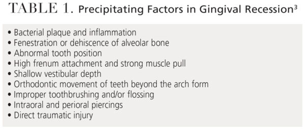 Understanding And Managing Gingival Recession - Decisions in Dentistry