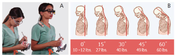 Ergonomically Optimal Loupes Support Proper Practice Posture ...