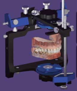 Complex Restorative Dentistry Aided by Digital Technology - Decisions ...