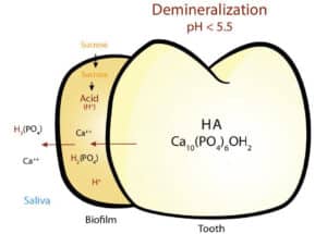 The Delicate Balance of Remineralization and Demineralization ...