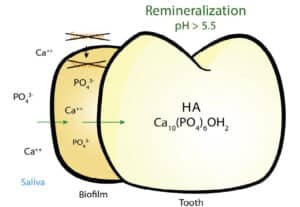 The Delicate Balance of Remineralization and Demineralization ...