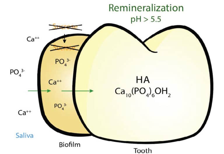 The Delicate Balance of Remineralization and Demineralization ...