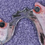 root-anchors - Decisions in Dentistry