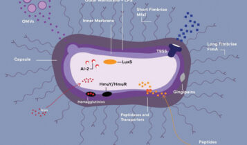 Perio Update - Decisions in Dentistry