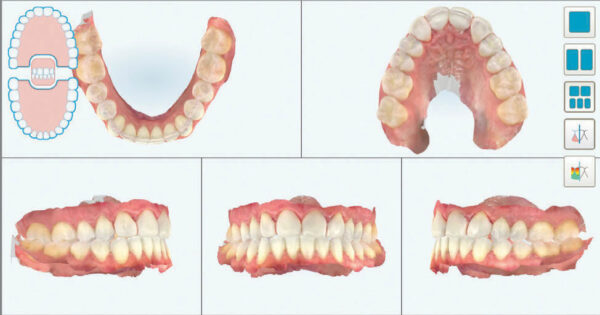 How to Leverage Digital Oral Health Scans - Decisions in Dentistry