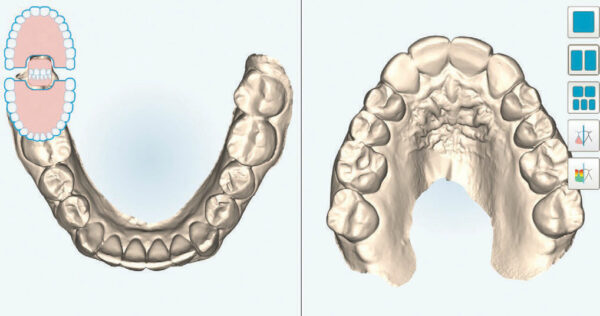 How to Leverage Digital Oral Health Scans - Decisions in Dentistry