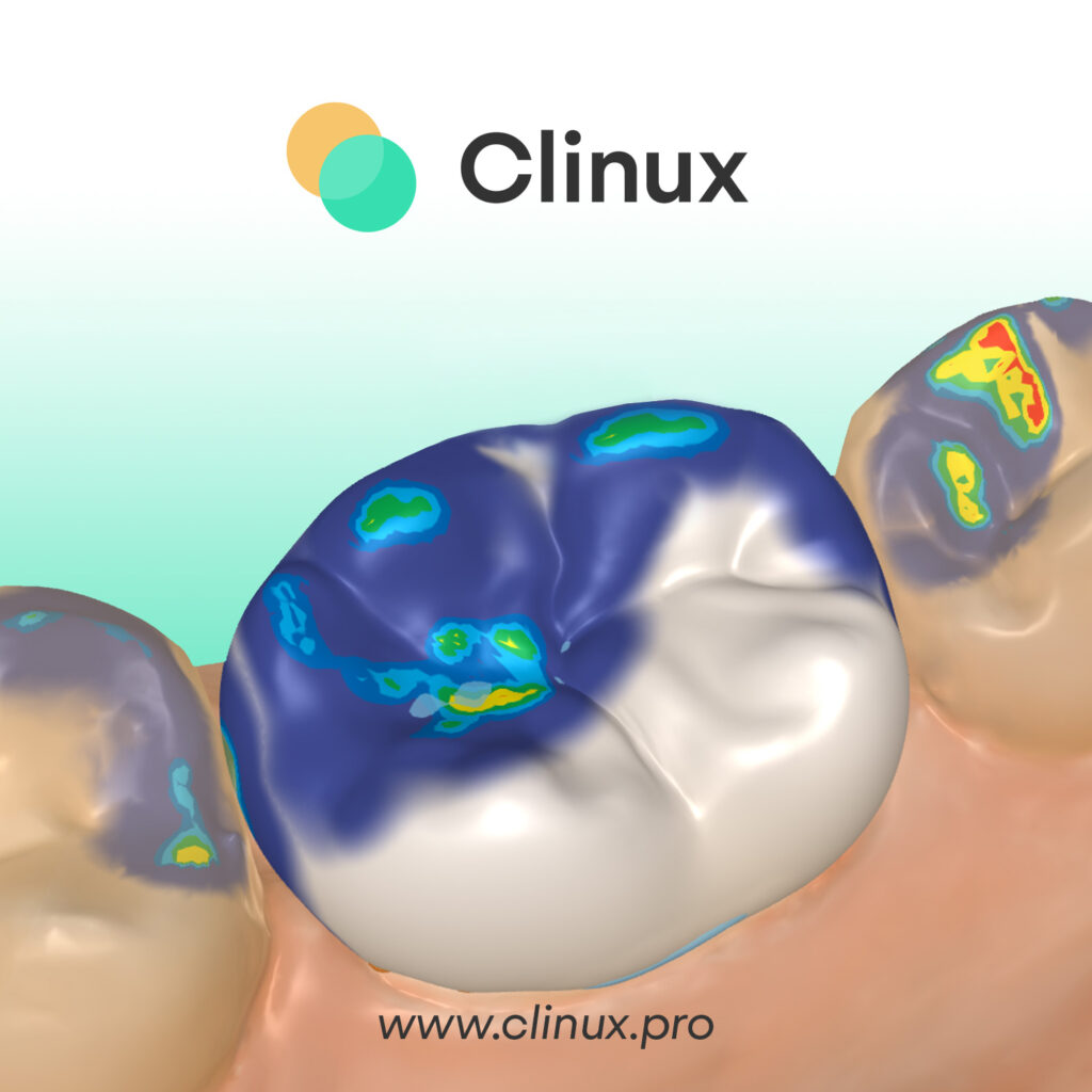 Clinux CAD Offers New Possibilities for Dentists with Innovative ...