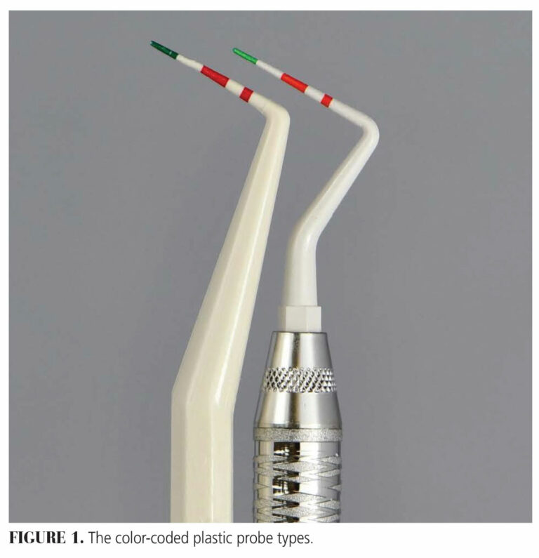 The Impact of Dental Probe Wear on Implant Health - Decisions in Dentistry