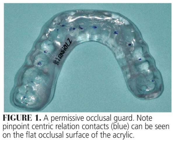 Occlusal Guards Are the Unsung Heroes of Muscle Deprogramming in the ...