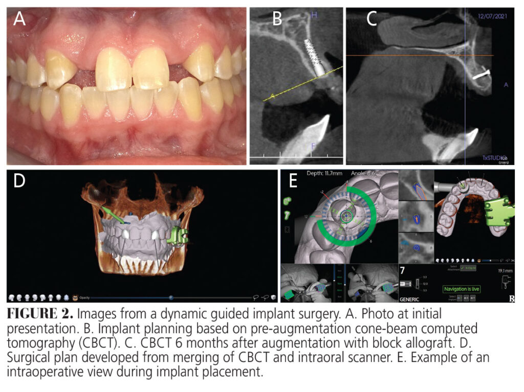 The Evolution of Cone-Beam Computed Tomography - Decisions in Dentistry