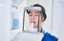 Alternative Esthetic Clasp For Removable Partial Dentures on Maxillary ...