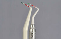 Mastering Subgingival Calculus Removal - Decisions in Dentistry