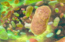 Esthetic Clasp Design for Removable Partial Dentures on Premolar Teeth ...