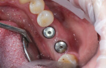 Making the Most of the New Periodontal Classification System ...