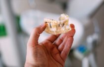 Using Fiducial Markers for Live Surgical Tracking - Decisions in Dentistry