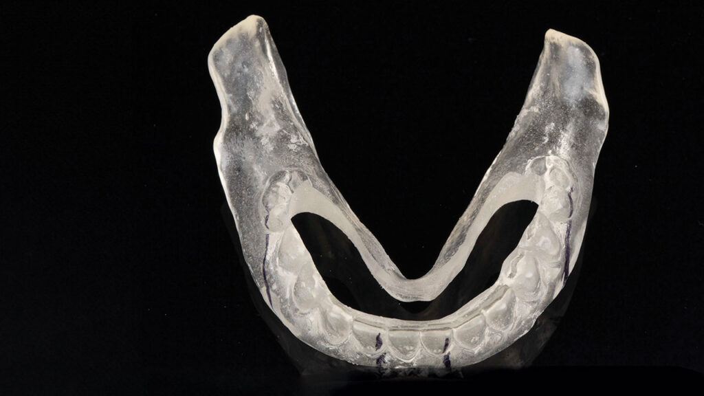Zirconia and Digital Planning Transform Full-Arch Implant Prostheses ...