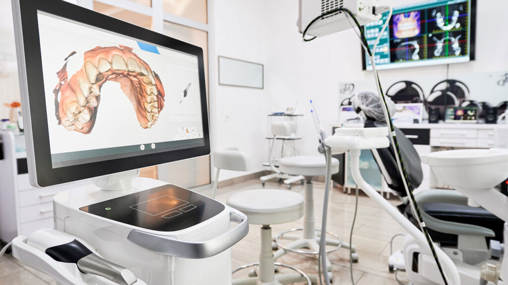 How Well Do You Know Digital Impressions? - Decisions in Dentistry