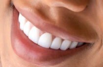 Teeth Tell the Story of the Genetic Code Behind Dental Evolution ...