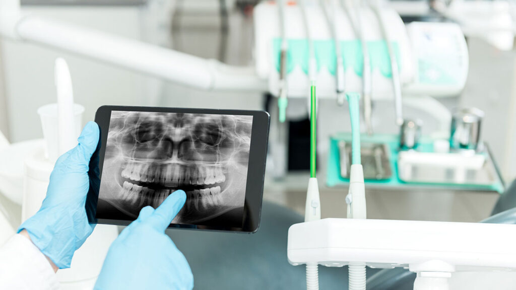 Why Routine Patient Shielding May No Longer Be Necessary - Decisions in ...